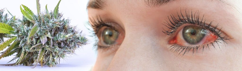 Why Does Weed Make Your Eyes Red? Here's the Science (and the Fix ...
